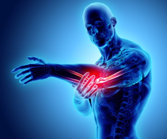 Types of Sports Injuries and How to Avoid Them - The Washington Note